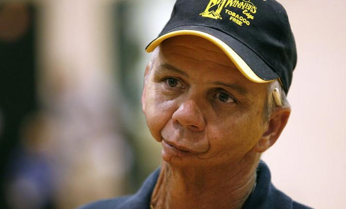 Rick Bender Before And After